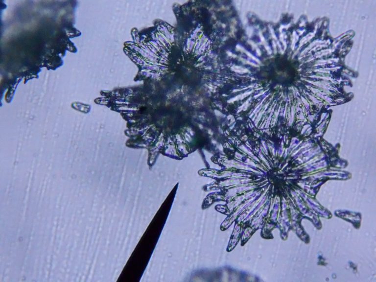 Observació dels tricomes d’una olivera (Olea europaea) | El bloc de ...
