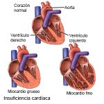 patologia cardiaca | Ciències per a grans descobridors