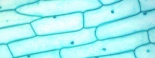 Observació de cèl·lules epitelials de la ceba – Labobloc de Biologia i ...