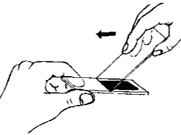 Observació dels bacteris d’un iogurt – Labobloc de Biologia i Geologia